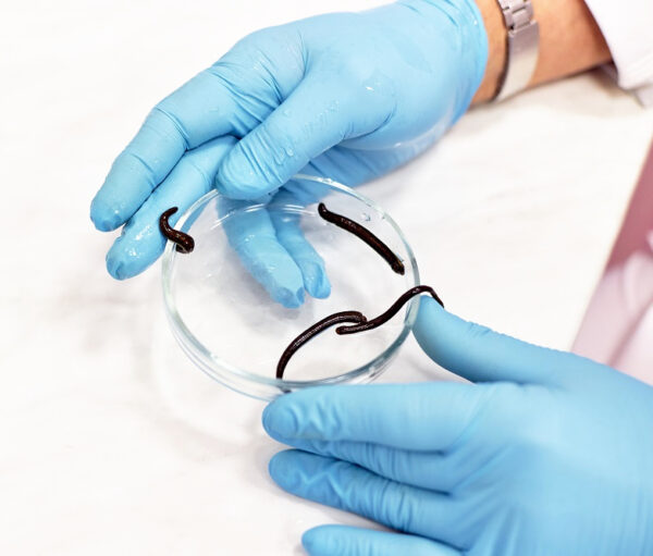 Właściwości terapeutyczne pijawek - Terapia Pijawką - hirudoterapia